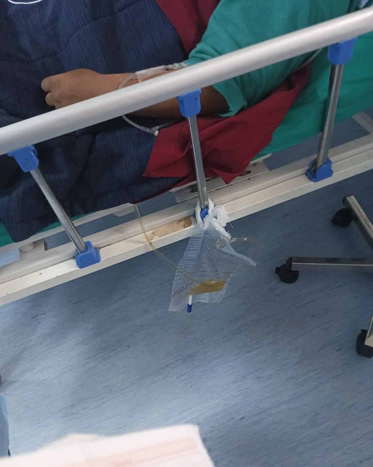 Enmanillado y con una sonda, así se encuentra el cocalero César Apaza ...