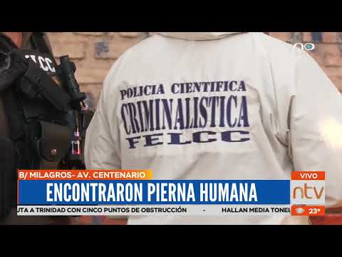 Encuentran una pierna humana en un contenedor de basura – deRedes.tv