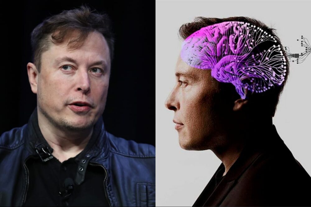El Primer Paciente Humano Al Que Se Le Implantó Un Chip Cerebral De